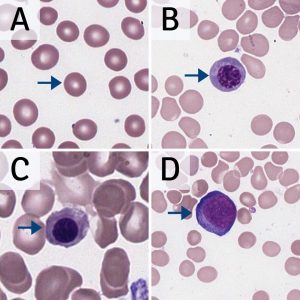 How Often Can I Donate Double Red Cells